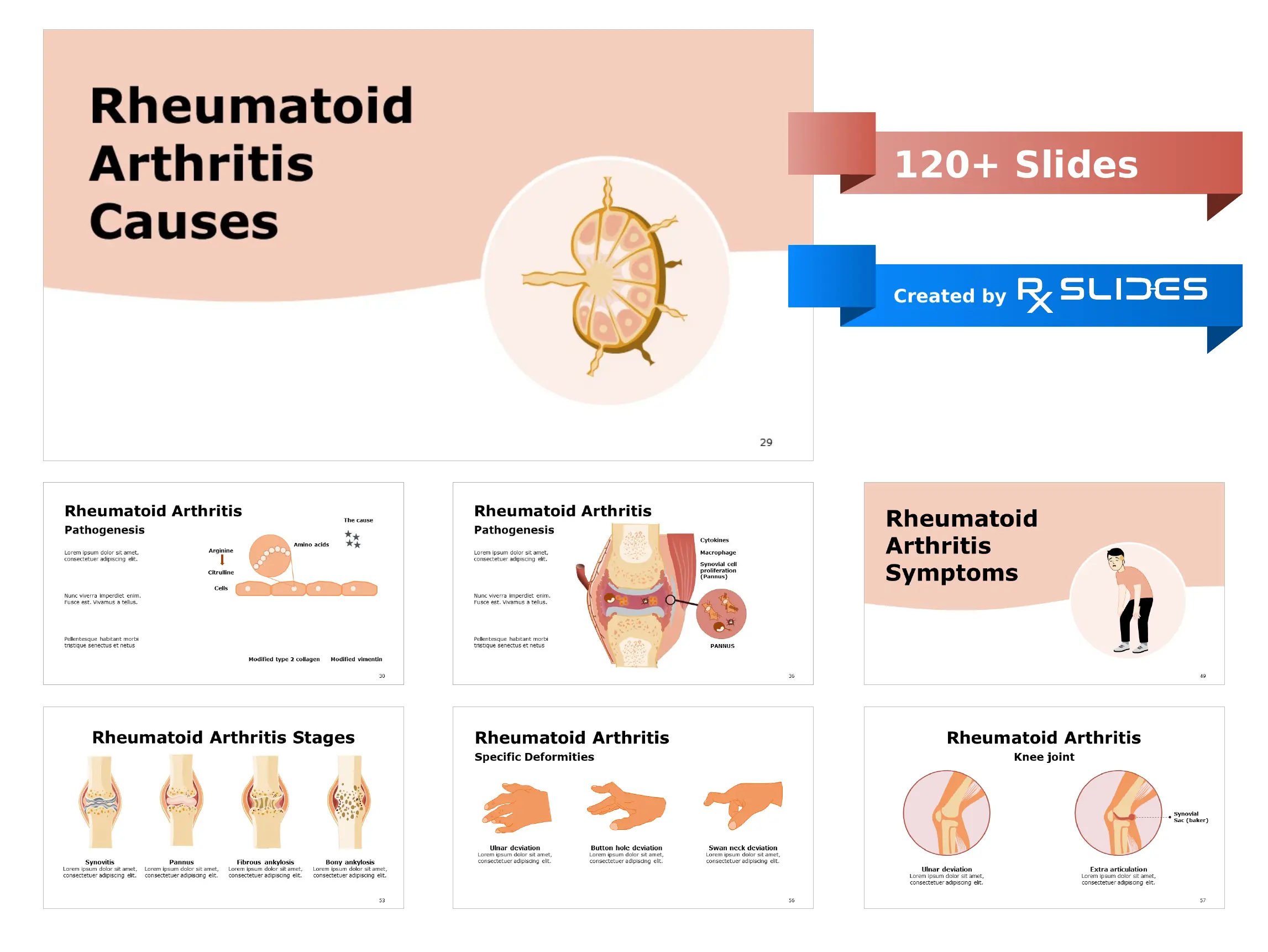 Download Rheumatoid Arthritis PowerPoint Template|RxSlides